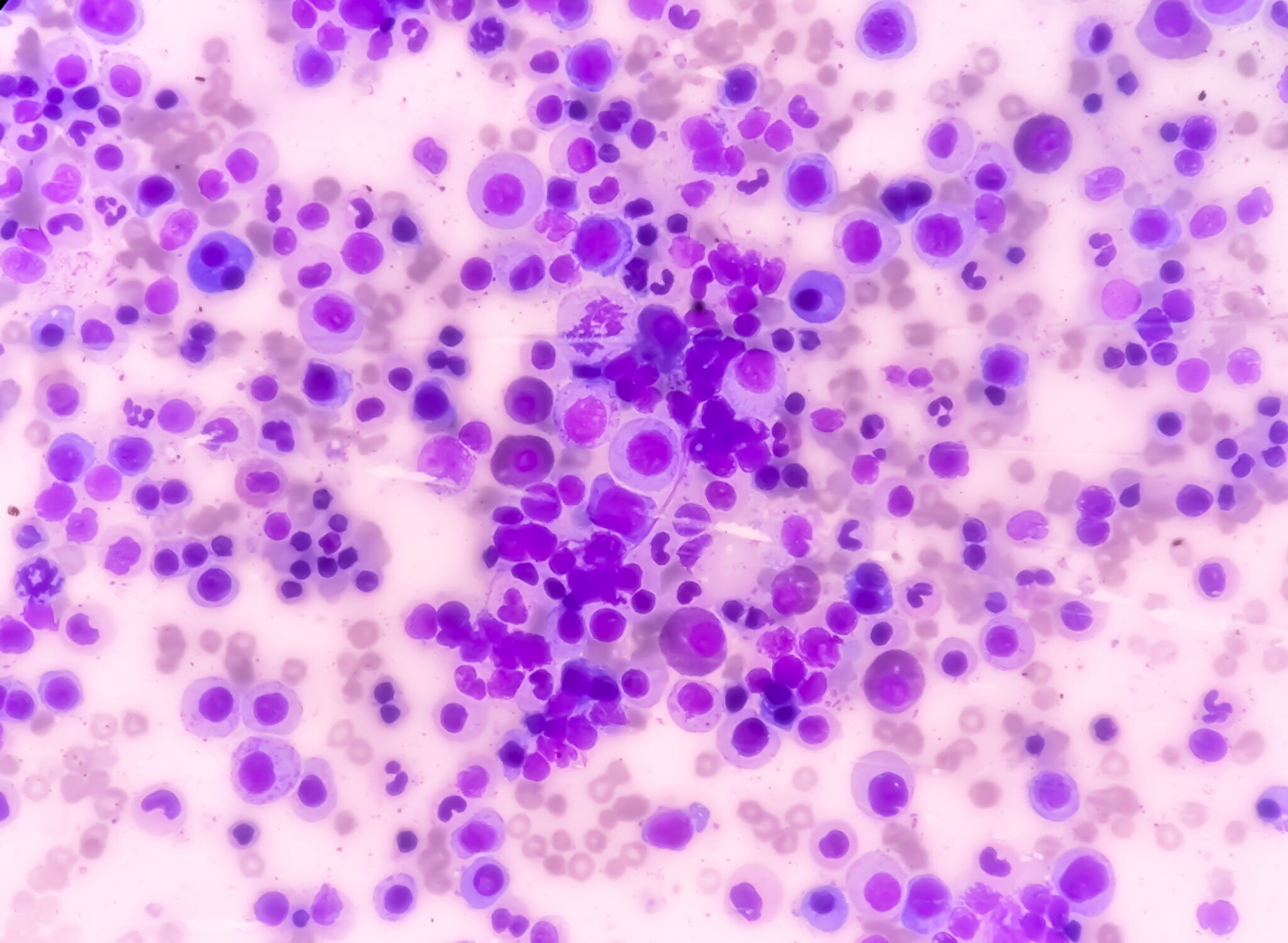 Blood Disease Drug Efficacy Testing | Discovery Life Sciences